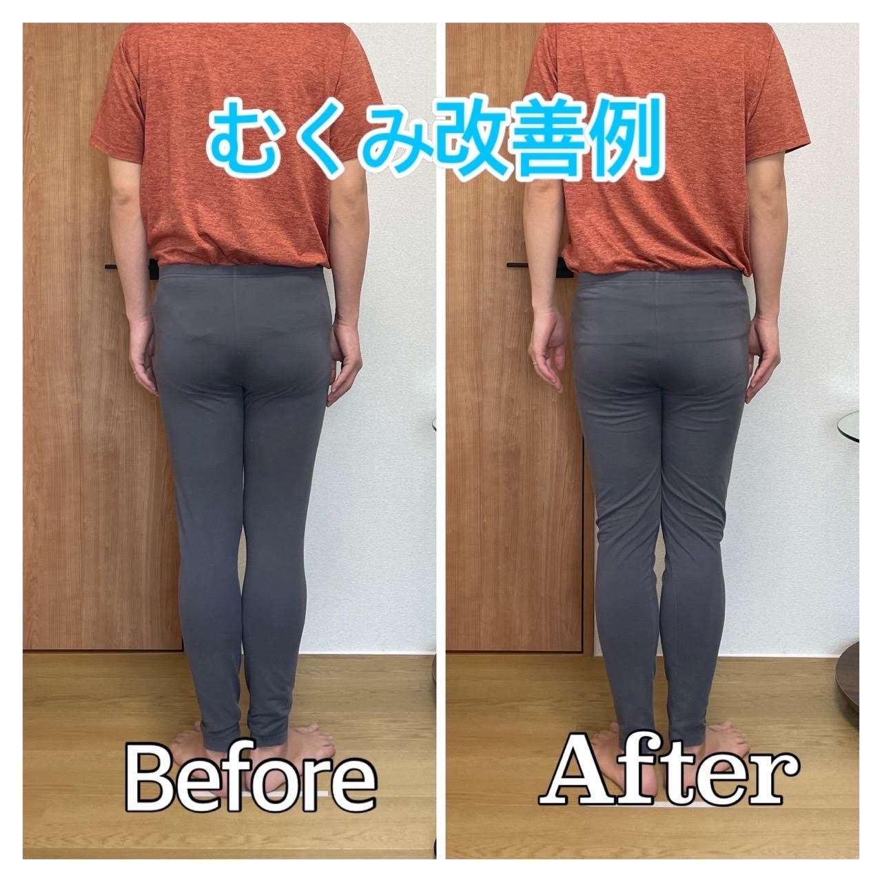 【腫れ、むくみとは？】 | ブログ | 恵比寿の整体ならメンズ美容整体 sjuni 恵比寿店