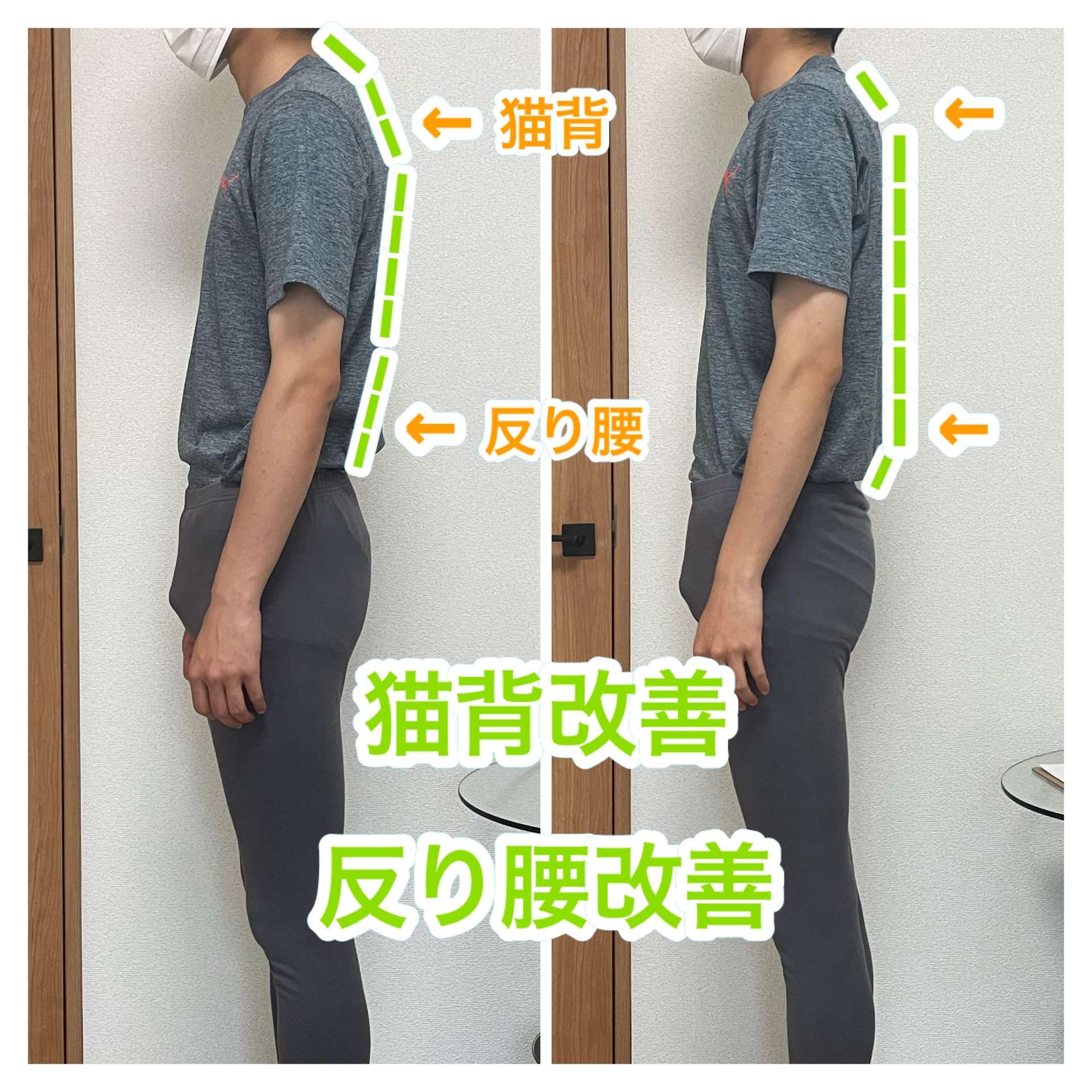 【猫背と反り腰はセットで起こりやすい】【メンズ美容整体サロンsjuni】 | ブログ | 恵比寿の整体ならメンズ美容整体 sjuni 恵比寿店